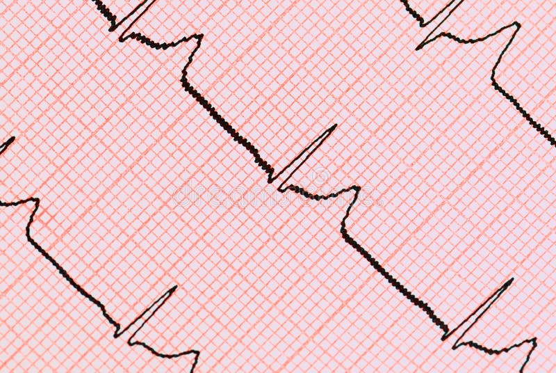 ECG graph stock image. Image of pulse, medicine, stability - 7117203