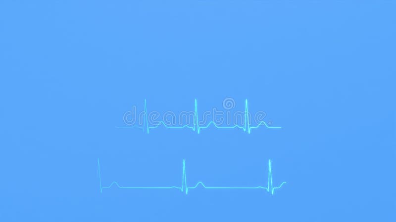 Comparison of ECG of Normal Heart Rhythm and AV Block 2nd Degree Stock ...