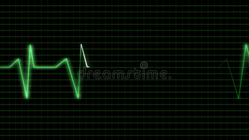 Green line ECG stock video. Video of heartbeat, glowing - 168326961
