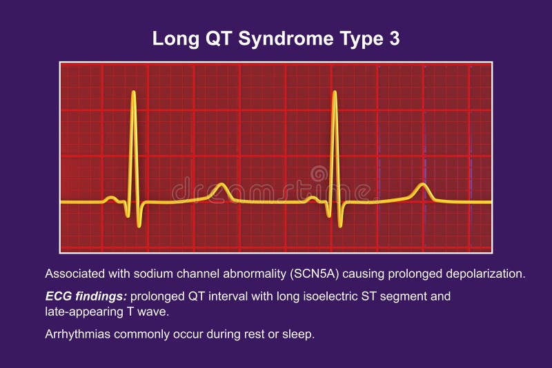 Long St Segment Stock Illustrations – 5 Long St Segment Stock ...