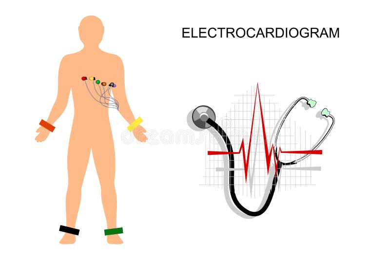 ECG, Paciente Com Os Elétrodos Na Caixa Ilustração do Vetor ...