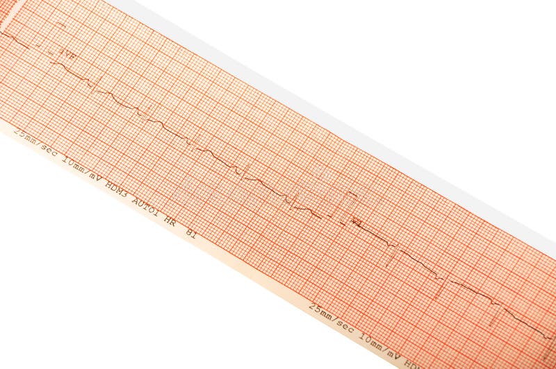 ECG print stock image. Image of blood, diagnose, cardiologist - 21872111
