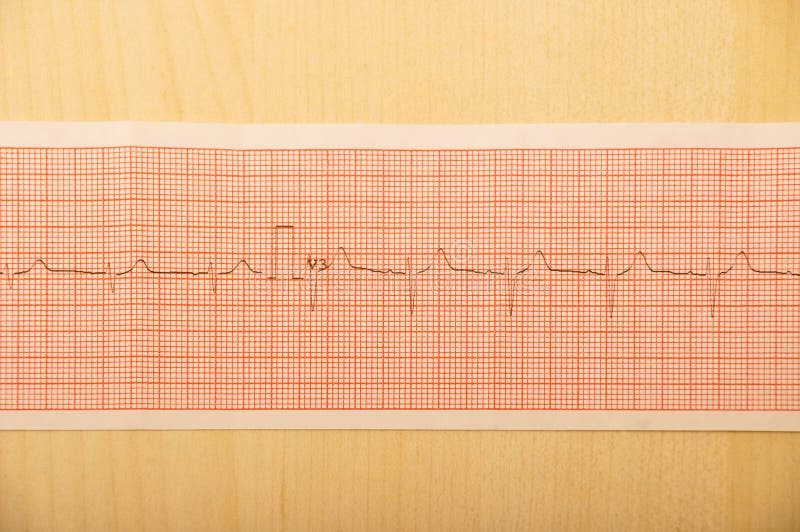 ECG print stock photo. Image of cardiologist, chart, heart - 66914696