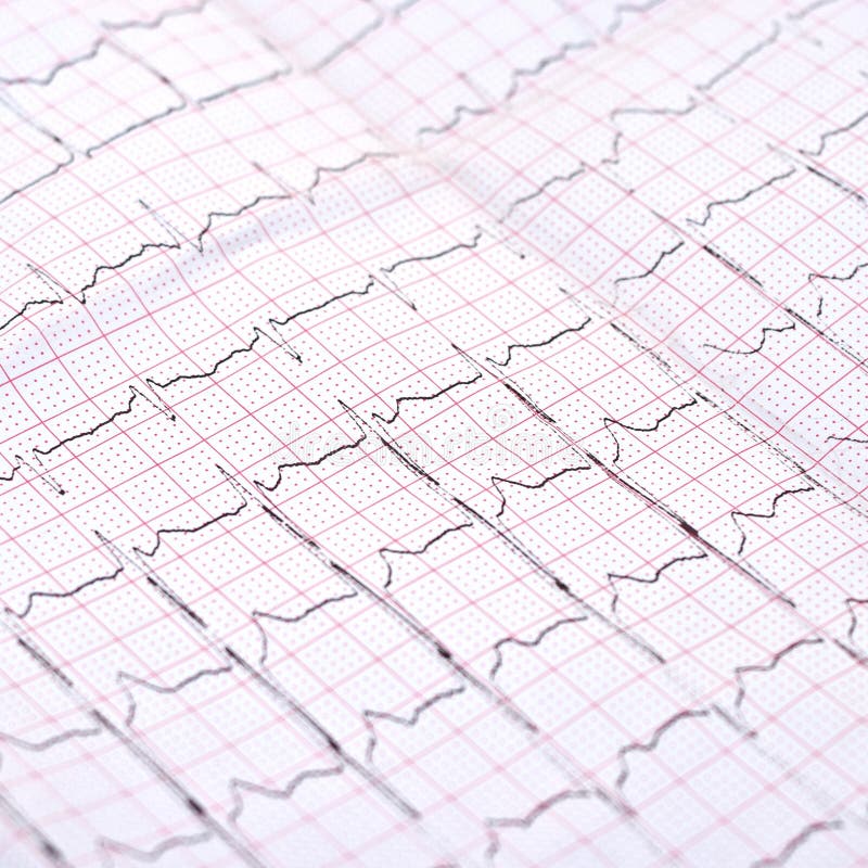 ECG printout stock photo. Image of chart, beat, diagnose - 3976654