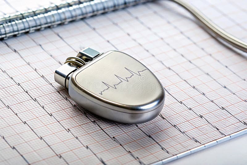 ECG Reading with Pacemaker Device â€ Detailed Electrocardiogram Paper ...