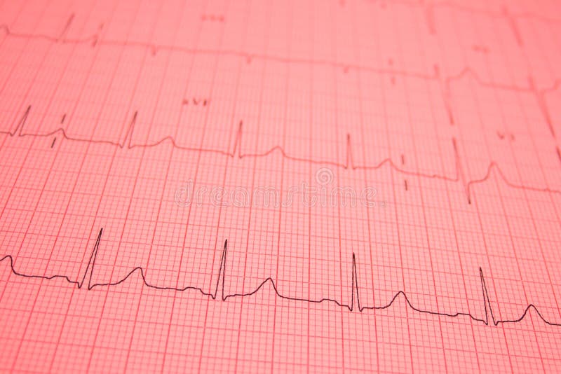 Normal ECG stock photo. Image of healthcare, screen, cardiologist - 1842238