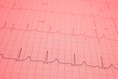 ECG red stock photo. Image of diagnosis, limits, cardiac - 325348