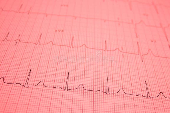 ECG red stock photo. Image of diagnosis, limits, cardiac - 325348