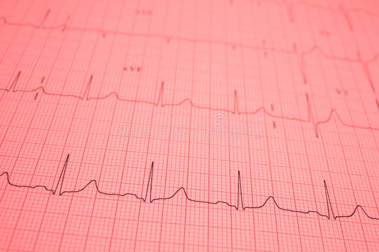 ECG red stock photo. Image of diagnosis, limits, cardiac - 325348