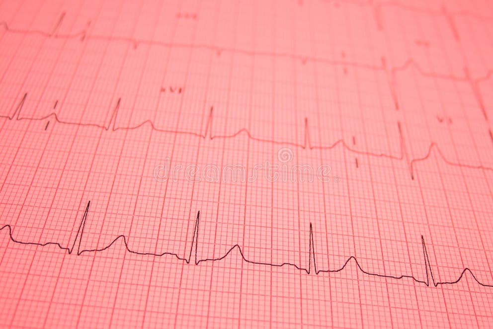 ECG red stock photo. Image of diagnosis, limits, cardiac - 325348