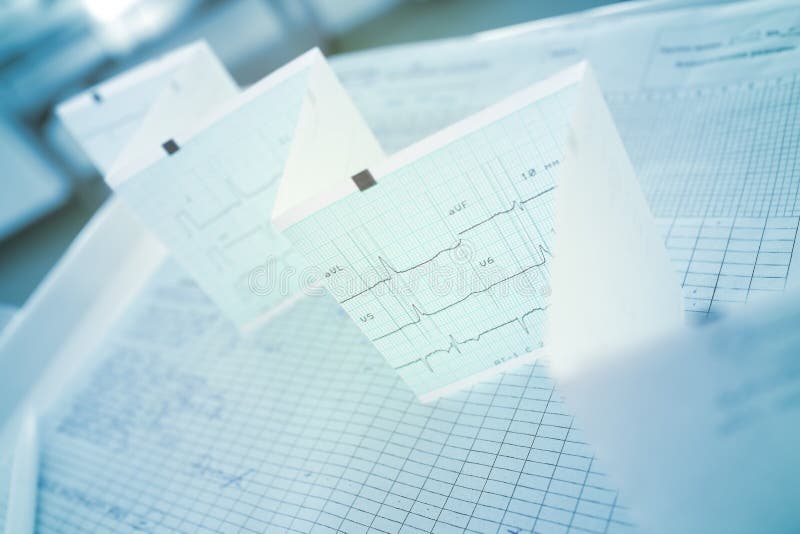 ECG-tape Against the Backdrop of the Hospital Ward Stock Image - Image ...
