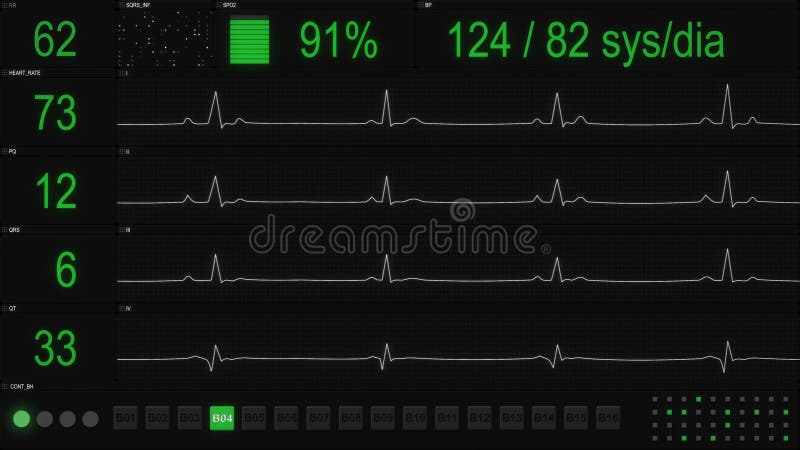 ECG Testing Software User Interface Stock Illustration - Illustration ...