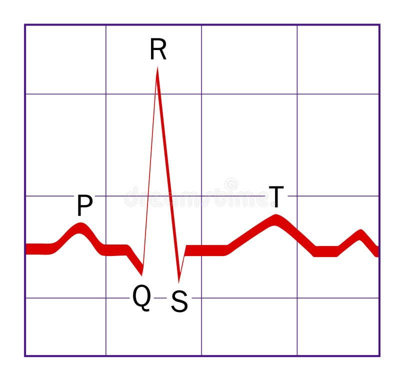 ECG trace stock illustration. Illustration of medical - 13398833