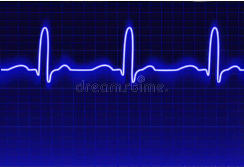 ECG trace stock vector. Illustration of abstract, heart - 8784423
