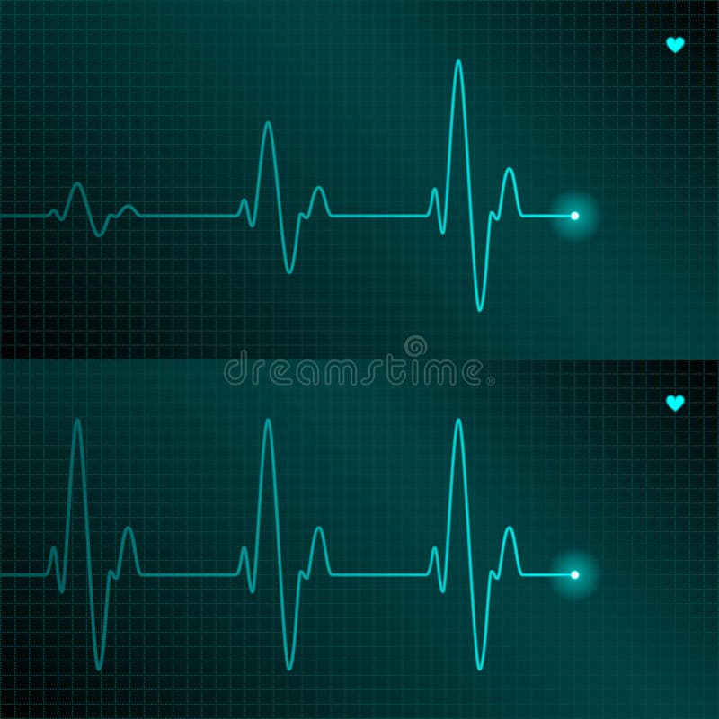 ECG tracing stock vector. Illustration of medicine, science - 11569965