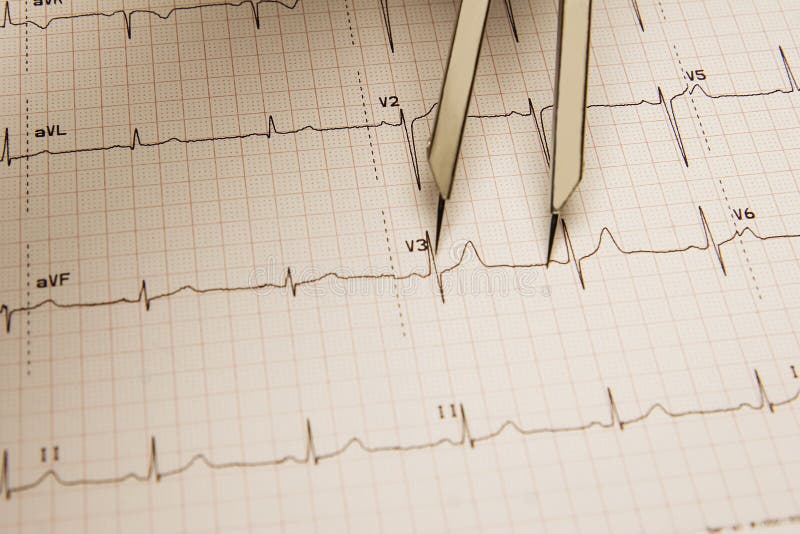 ECG tracing stock photo. Image of equipment, life, line - 7971714