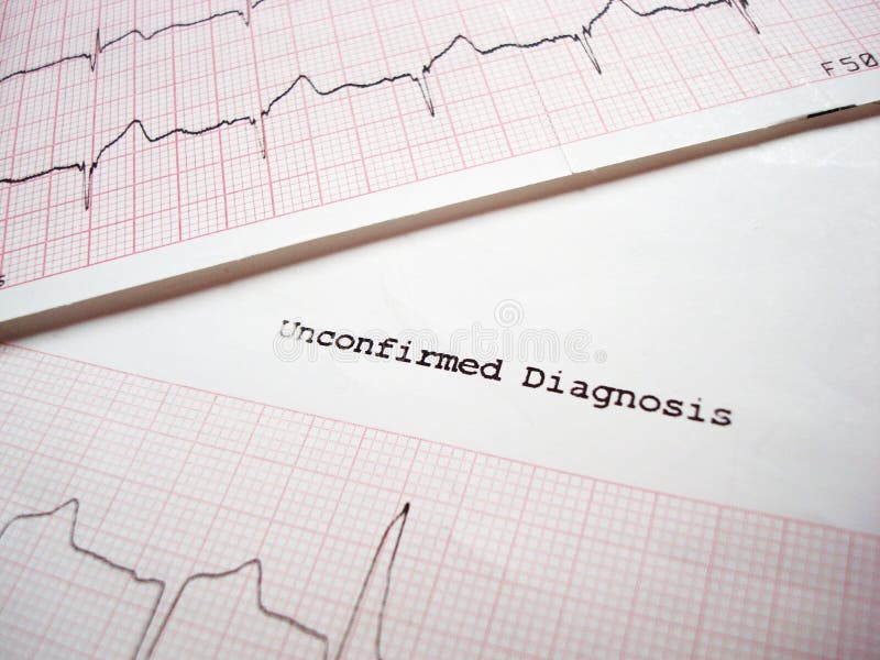 ECG unconfirmed diagnosis stock image. Image of cardiac - 14882389