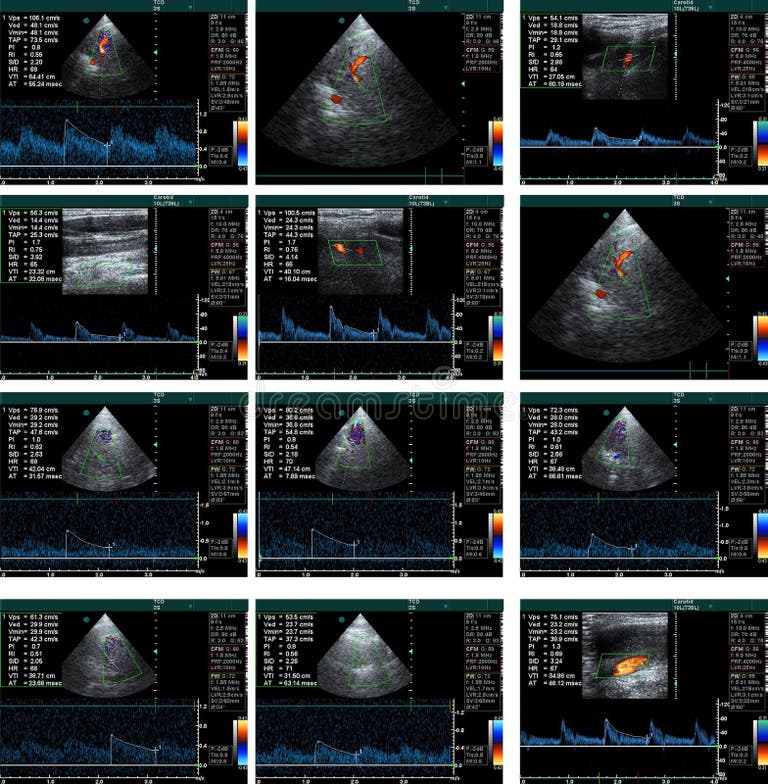 4,652 Echo Medical Stock Photos - Free & Royalty-Free Stock Photos from ...