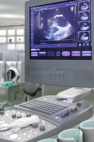 Echo Machine, Ultrasound Machine. Photo. Stock Photo - Image of ...