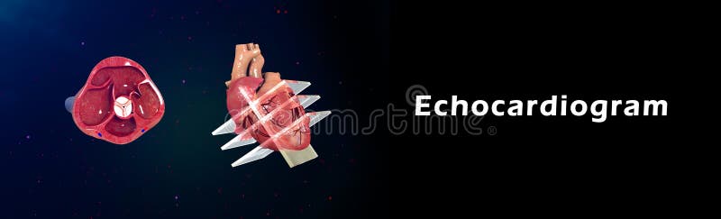 Echocardiogram stock illustration. Illustration of motion - 82869398