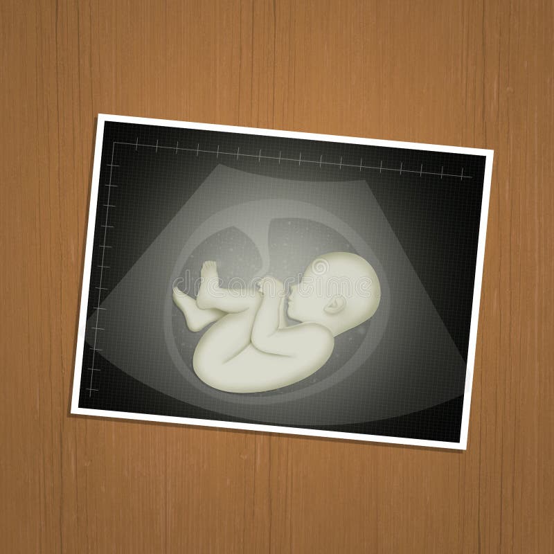 Echography of baby stock illustration. Illustration of birth - 106066646