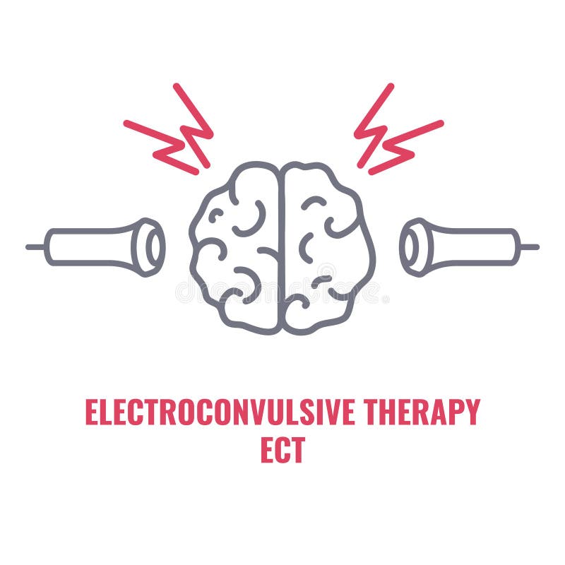 Electroconvulsive Therapy Stock Illustrations – 47 Electroconvulsive ...