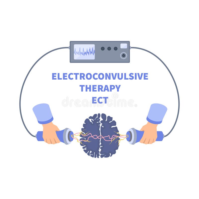 ECT Electroconvulsive Therapy for Severe Depression Treatment Stock ...