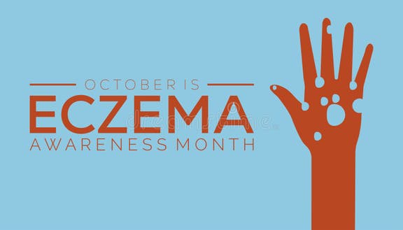 Eczema Awareness Month is Observed Every Year on October. Stock Vector ...