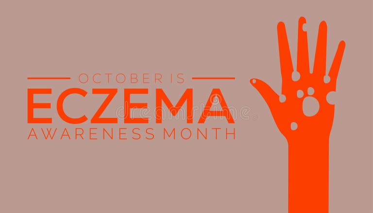 Eczema Awareness Month is Observed Every Year on October. Stock Vector ...