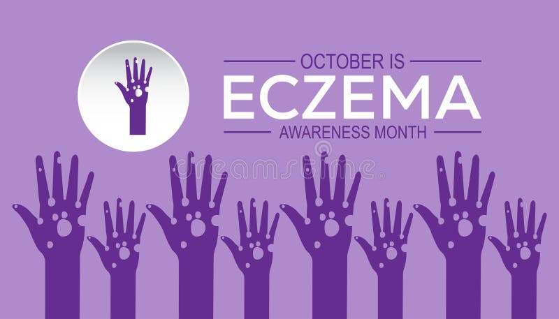 Eczema Awareness Month is Observed Every Year on October. Stock Vector ...