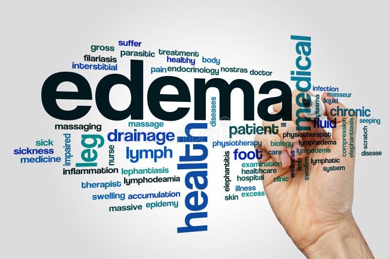 Edema Word Cloud Concept Grey Background Stock Photos - Free & Royalty ...