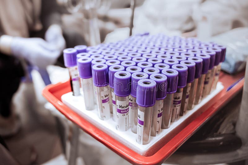 Jakarta, Indonesia - March 30, 2022: Blood Sample Test Tubes Ready To ...