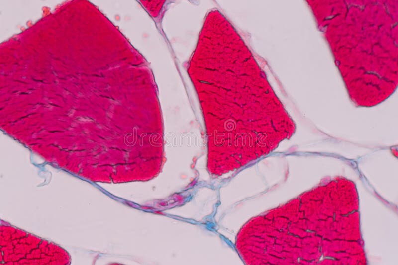 Histological Sample Striated Muscle Tissue Under the Microscope. Stock ...
