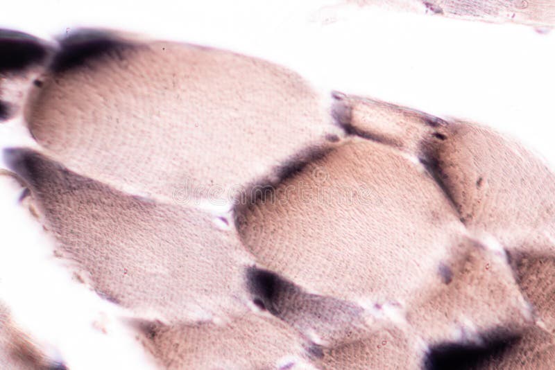 Histological Sample Striated Muscle Tissue Under the Microscope. Stock ...