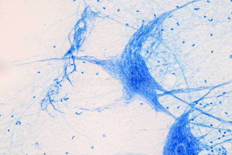 Motor Neuron Under the Microscope. Stock Image - Image of horn, cord ...