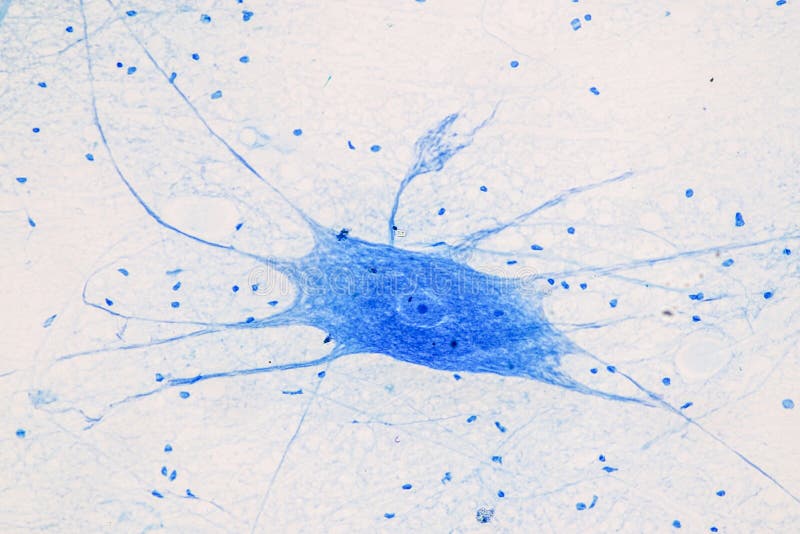 Motor Neuron Under the Microscope. Stock Image - Image of dendrites ...