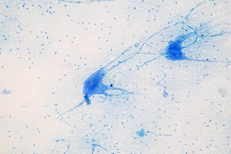 Motor Neuron Under the Microscope. Stock Image - Image of dendrite ...
