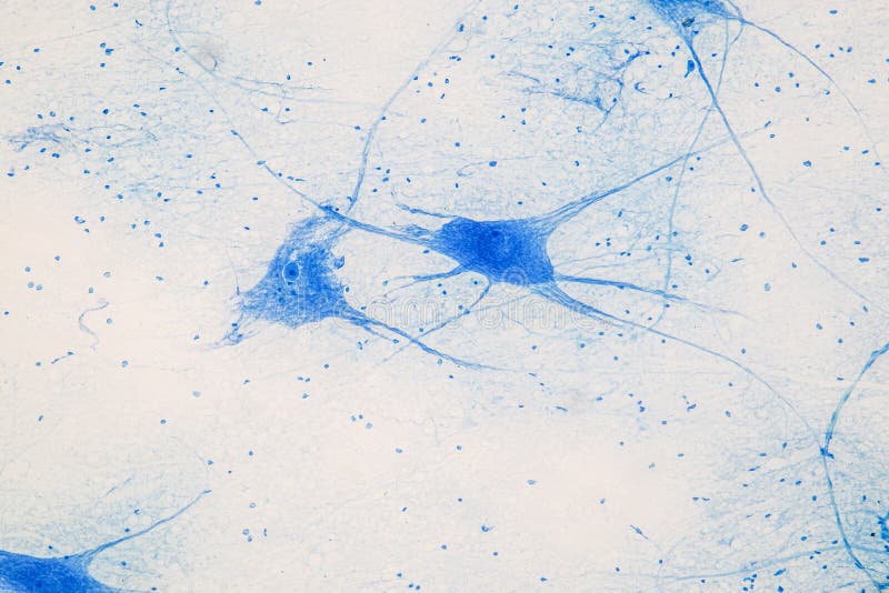 Motor Neuron Under the Microscope. Stock Image - Image of cord, impulse ...
