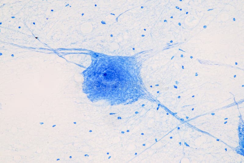 Motor Neuron Under the Microscope. Stock Photo - Image of histological ...