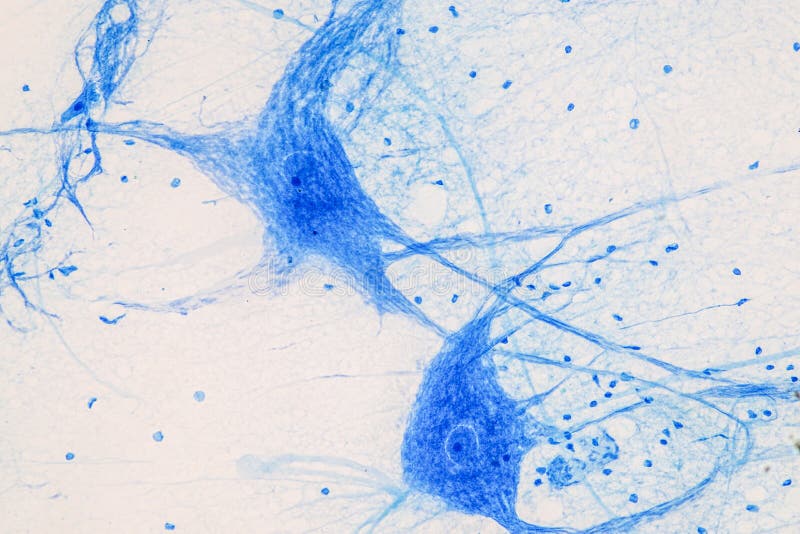 Motor Neuron Under the Microscope. Stock Photo - Image of central ...