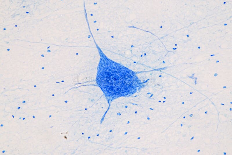 Motor Neuron Under the Microscope. Stock Image - Image of cord, labn ...