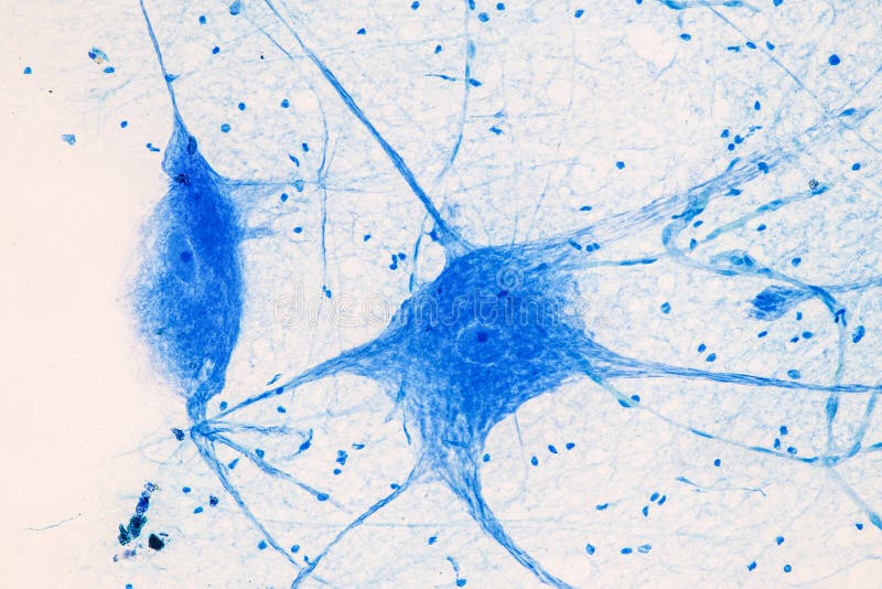 Motor Neuron Under the Microscope. Stock Image - Image of microscopy ...