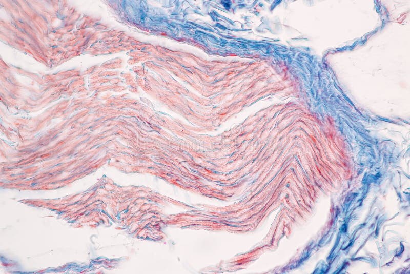 Spinal Cord and Motor Neuron Under the Microscope. Stock Image - Image ...