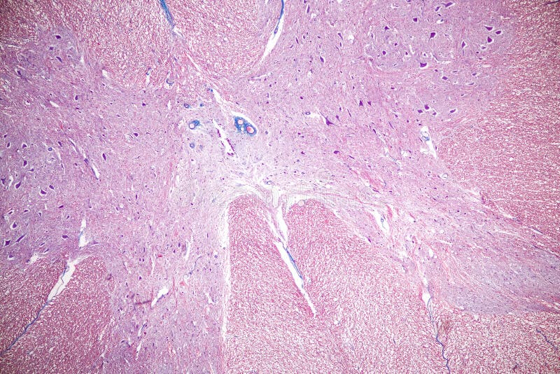 Spinal Cord, Nerve, Cerebellum, Cortex and Motor Neuron Human Under the ...