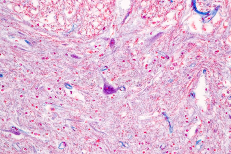 Spinal Cord, Nerve, Cerebellum, Cortex and Motor Neuron Human Under the ...