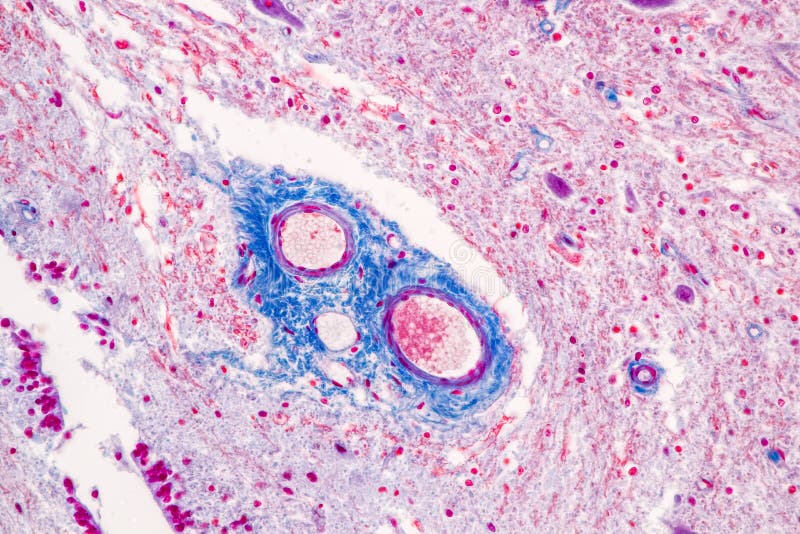 Spinal Cord, Nerve, Cerebellum, Cortex and Motor Neuron Human Under the ...