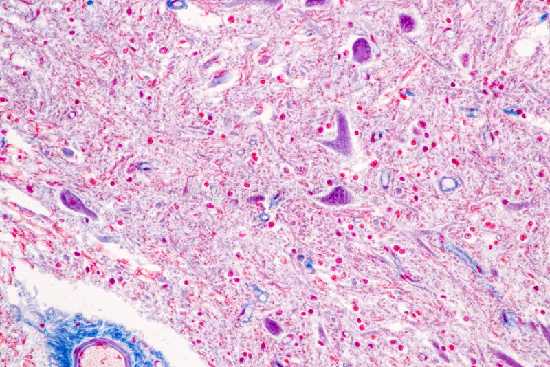 Spinal Cord, Nerve, Cerebellum, Cortex and Motor Neuron Human Under the ...