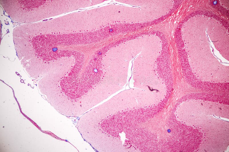 Spinal Cord, Nerve, Cerebellum, Cortex and Motor Neuron Human Under the ...