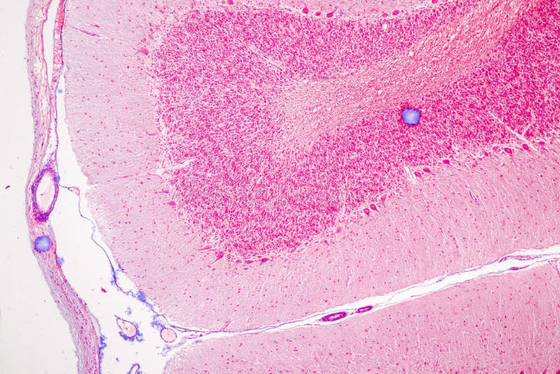 Spinal Cord, Nerve, Cerebellum, Cortex and Motor Neuron Human Under the ...