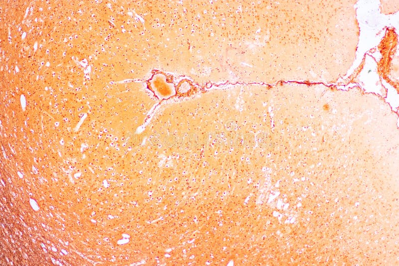 Spinal Cord, Nerve, Cerebellum, Cortex and Motor Neuron Human Under the ...